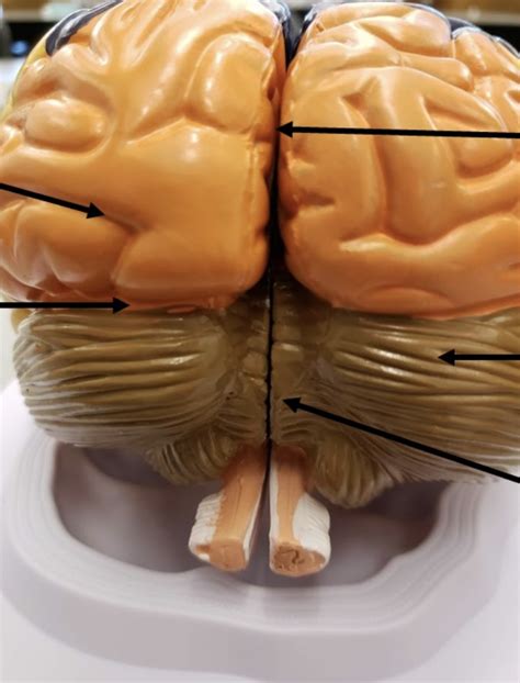 Posterior View Of Brain Diagram Quizlet