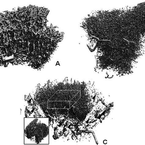 three dimensional vessel imaging of tibia metaphysis using conventional