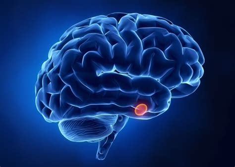 La gestion médicale de l apoplexie hypophysaire donne des résultats similaires à la chirurgie