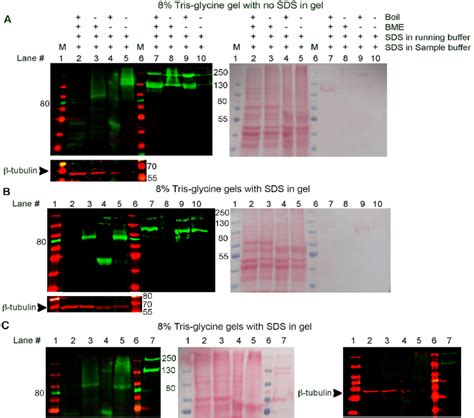 Western Blot Of Rat Muscle Lysates And Purified Rat Tail Collagen Type