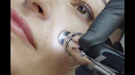 Mesoporation Fractional Evolution Luxus Plasmaliner Youtube