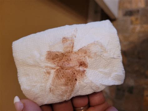 12 Dpo Implantation Bleeding Implantation Bleeding Or Af 12 Dpo