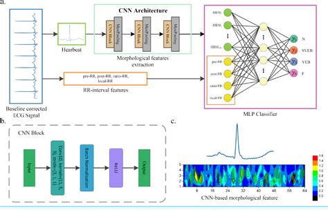 Figure 1 From A Hybrid Method For Heartbeat Classification Via Convolutional Neural Networks