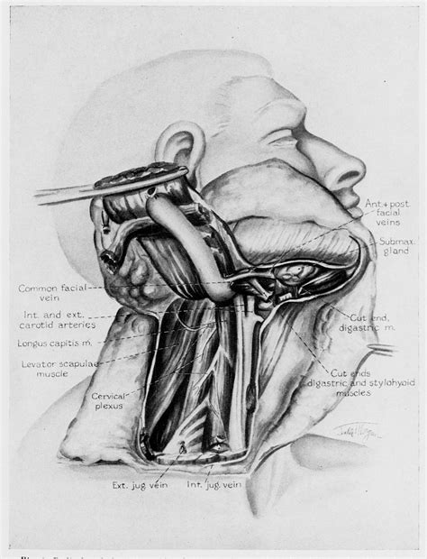 Figure 2 From Role Of Radical Neck Dissection In Oral Carcinoma
