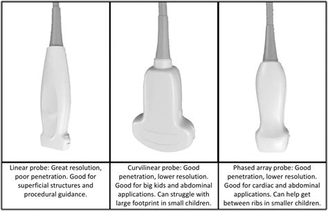 What Does A Probe Do At Sam Hamby Blog