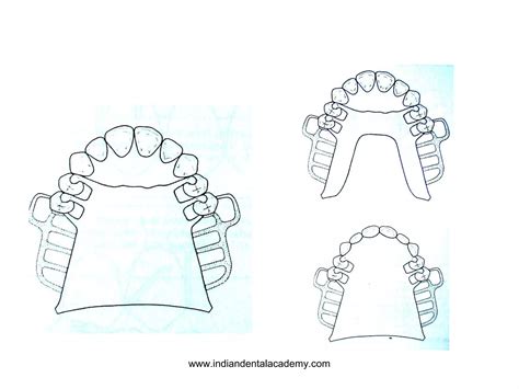 Mandibular Class I Situationendodontic Courses Ppt