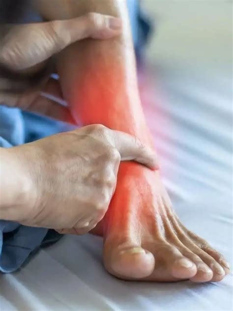 Hyperuricemia என்றால் என்ன இதன் அறிகுறிகள் என்ன Tamilsamayam