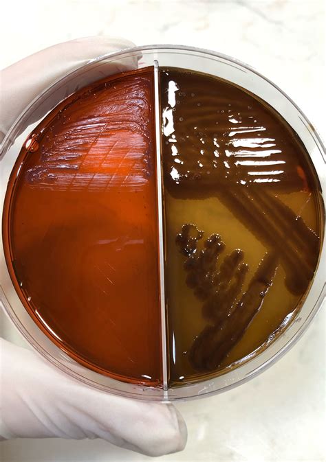 Agar Pseudomonas Aeruginosa Emb Agar Pseudomonas Aeruginosa Emb