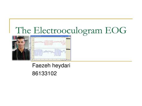 Ppt The Electrooculogram Eog Powerpoint Presentation Free Download Id6737433