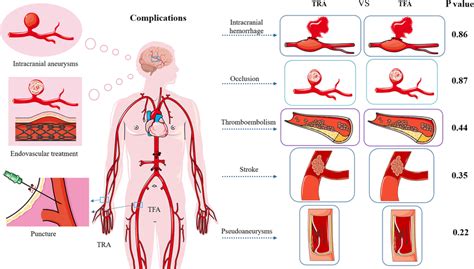 The Comparison Of Complication Outcomes Between Tra And Tfa Tra