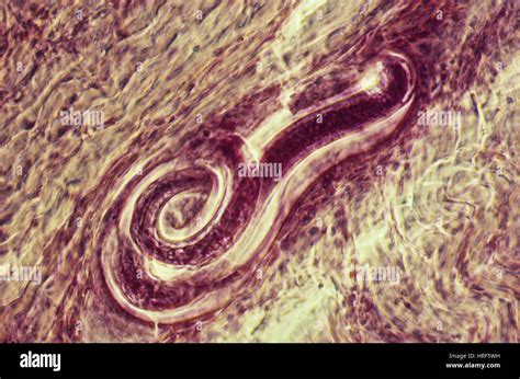 Trichinella Spiralis Morphology