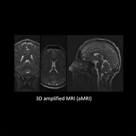 Dr Snejana Kovatch Eva On Linkedin Ai Artificialintelligence Machinelearning Society
