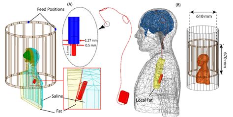 Simulation Setups With Experiment Mimicking Phantom Model A And Download Scientific Diagram