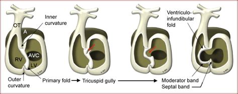 An Overview Of Cardiac Morphogenesis Thoracic Key