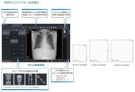 診療所向けxsy Anesis・radspeed Pro Style Edition組み合わせご提案 株式会社島津製作所