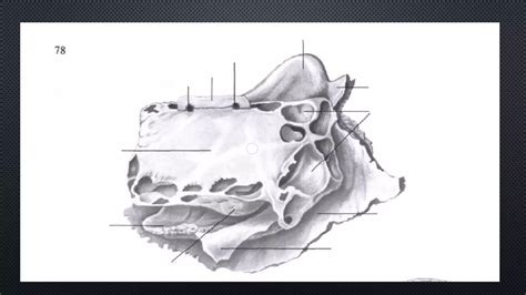 Sphenoid And Ethmoid Bones Pptx Bone And Joint Conditions
