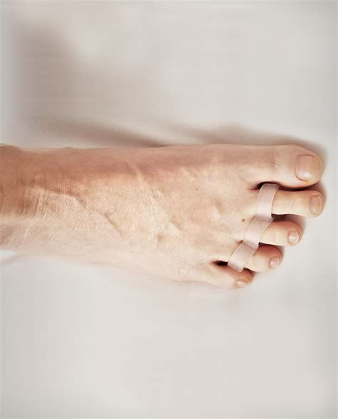 Pedecare Gel Triple Loop Toe Seperators — Pedecare