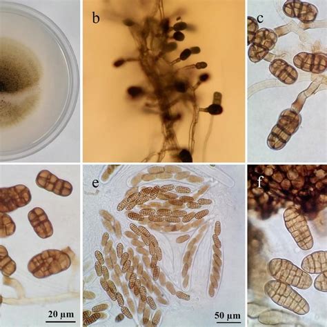 Stemphylium Eturmiunum Iran 2600 C A Colony On Pca B Fascicle Of