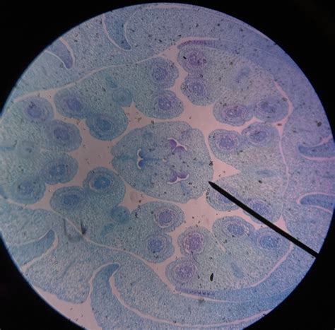 Monocot Flower Bud Structure Diagram Quizlet