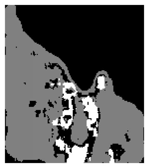 Classification Result By Arm Ain Download Scientific Diagram