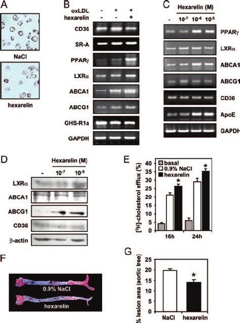 Activation Of The Ppar ␥ Lxr ␣ Abca1g1 Pathway In Peritoneal