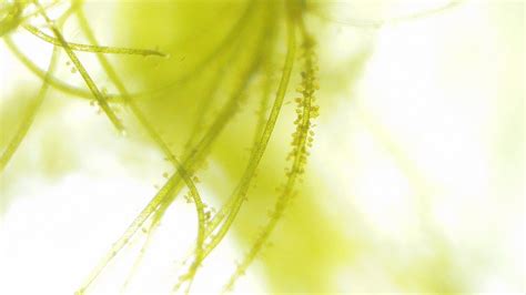 Help Id This Pest Algae Microscope Images Included Reef2reef