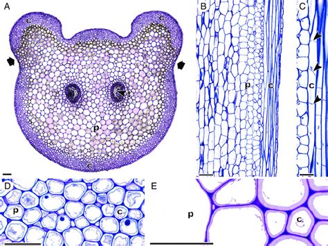 Transverse A D E And Longitudinal B C Sections Through The Download Scientific Diagram