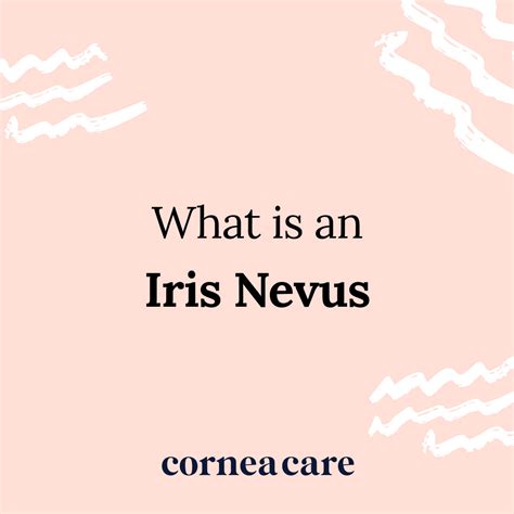 Iris Nevus Corneacare