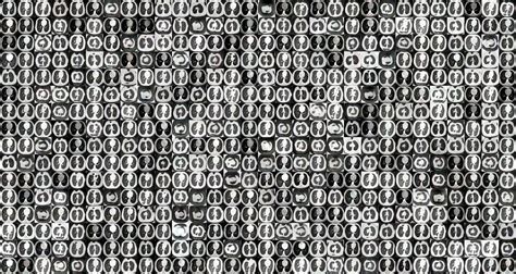 Towards Data Science On Linkedin Enhancing Cancer Detection With Stylegan 2 Ada