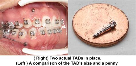 Unlocking The Power Of Tads Expert Insights From Dr Kanaan Your Key