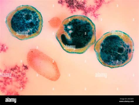 Chlamydia Pneumoniae Bacteria Coloured Transmission Electron