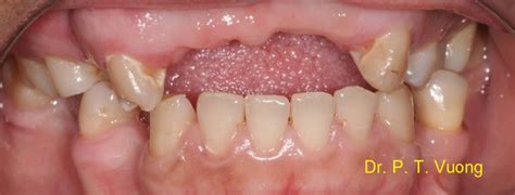 Dr Phuoc Vuong Dentist Phuoc T Vuong Dmd Ms Dr Phil T Vuong