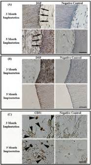 Immunostaining Indicates Strong Dentin Sialoprotein Dsp Expression Download Scientific