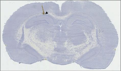 A Spaghetti Plot Of Individual Inputoutput Curves And Average Download Scientific Diagram