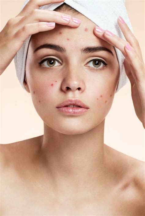 Shingles Vaccine Side Effects Is It Even Worth Taking