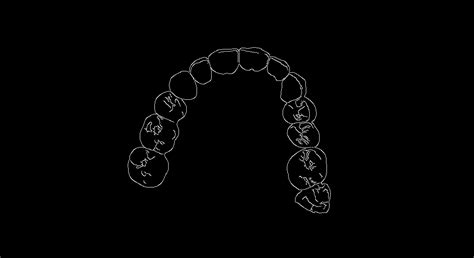 Python Return Position And Size Of Arbitraryteeth Shapes In Image Using Opencv Stack Overflow