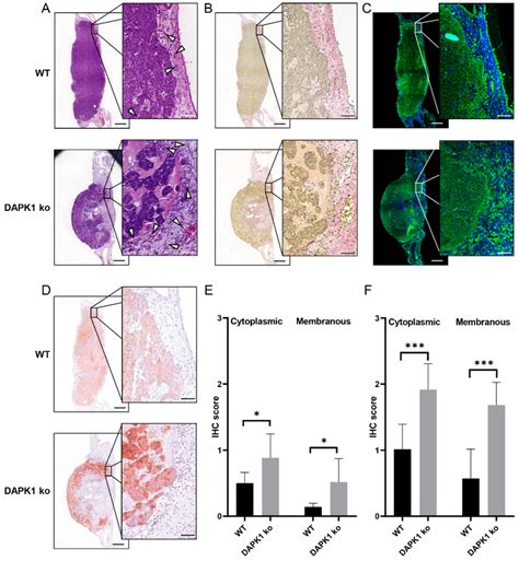 Evaluation Of Qualitative Collagen Fiber Density And Distribution As Download Scientific