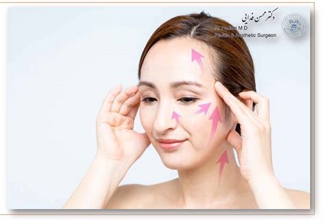 Endotine Facelift Face Lift Surgery With Endotine Drmohsen Fadaei