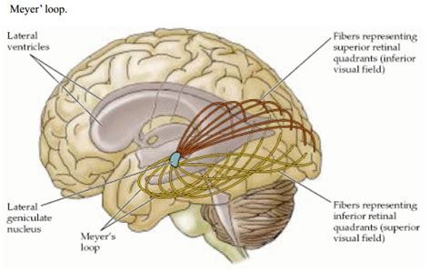 Optic Radiation In The Human Brain Optical Radiation Wavelengths Ray