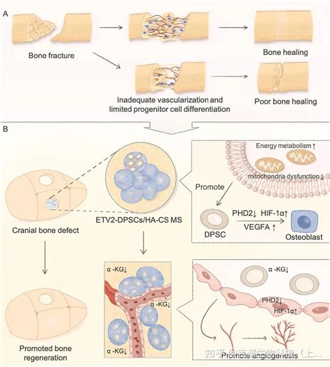 徐建光王元银团队在骨缺损修复方面研究取得新突破 知乎