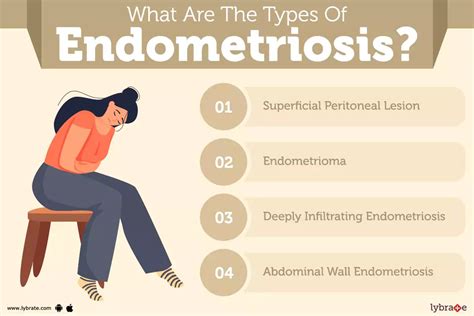 Endometriosis Causes And Symptoms Menstrual Cramps Or Endometriosis