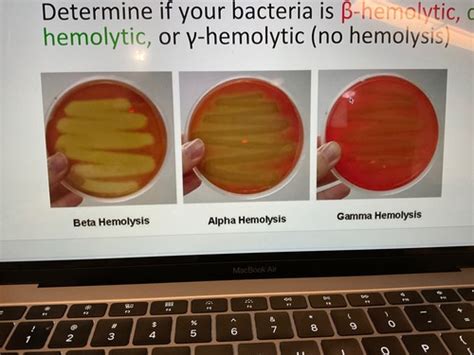 Microbiology Lab Final Flashcards Quizlet