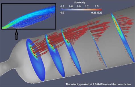 Journal And Conferences On Biomedical Engineering A Multi Layer Non Newtonian Model Of