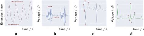 Biosignals Learning And Synthesis Using Deep Neural Networks