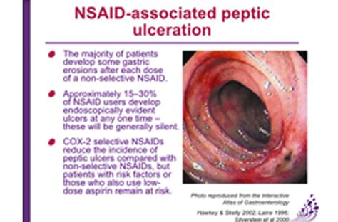 Nsaid Syndrome
