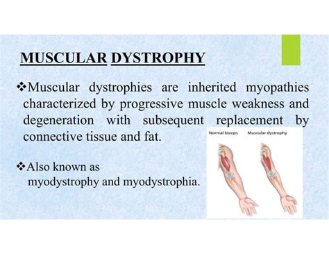 Muscular Dystrophy Ppt Pdf Pdf