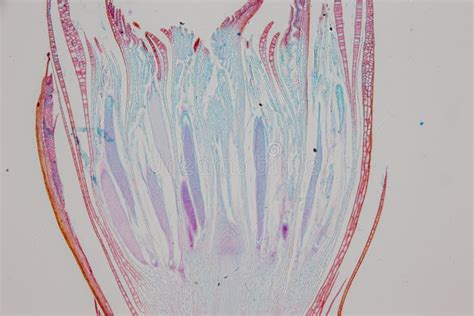 Células Reproductivas De Plantas Florecientes Bajo Microscopía Foto De
