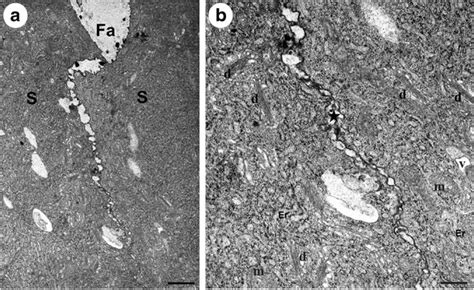 T Tenuifolium Ultrastructure Of Synergid Cells A Filiform Apparatus
