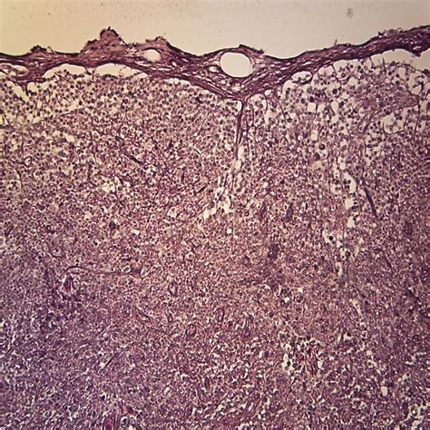 Reticular Fibers Lymph Node