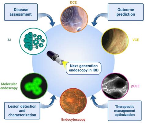 Enhancing Diagnosis And Disease Monitoring For Ulcerative Colitis • Healthcare In